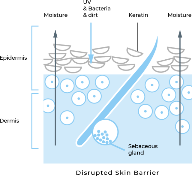 What is Lumi Eyes Treatment? Discover the Benefits and Side Effects