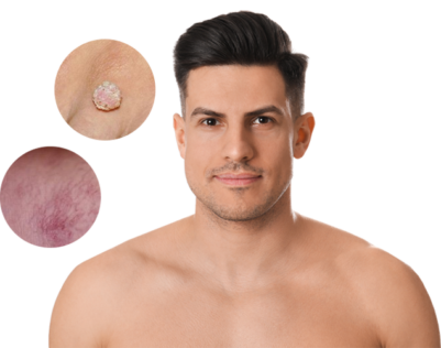 Skin Imperfections - CoLaz Aesthetics Clinic