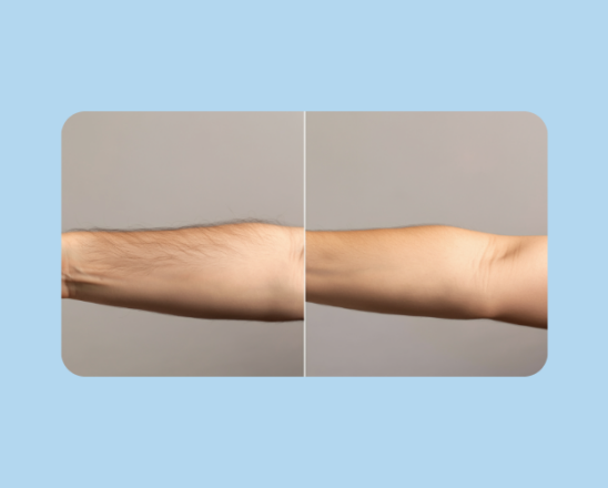 11 Pros and 10 Cons of Arm Hair: Which is Better For You?