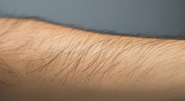 11 Pros and 10 Cons of Arm Hair: Which is Better For You?