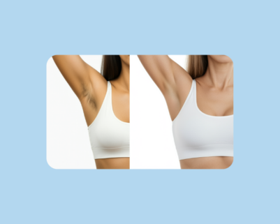 5 Pros and 5 Cons of Armpit Hair | Comfort & Style